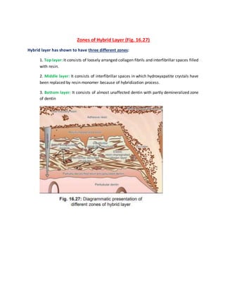 Bonding to Enamel and Dentin Bonding to Enamel and Dentin | DOCX