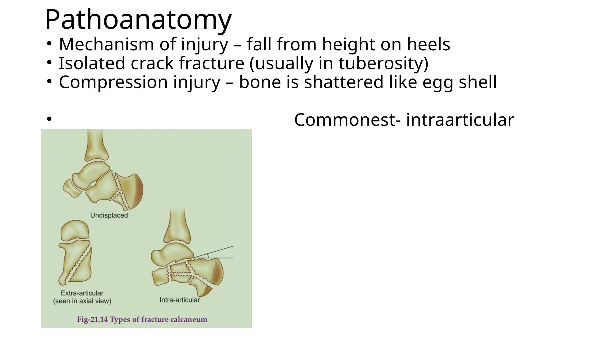 Injuries fractures of leg foot and kneee | PPT