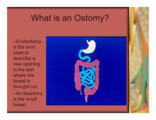 Living Life with an Ostomy | PDF