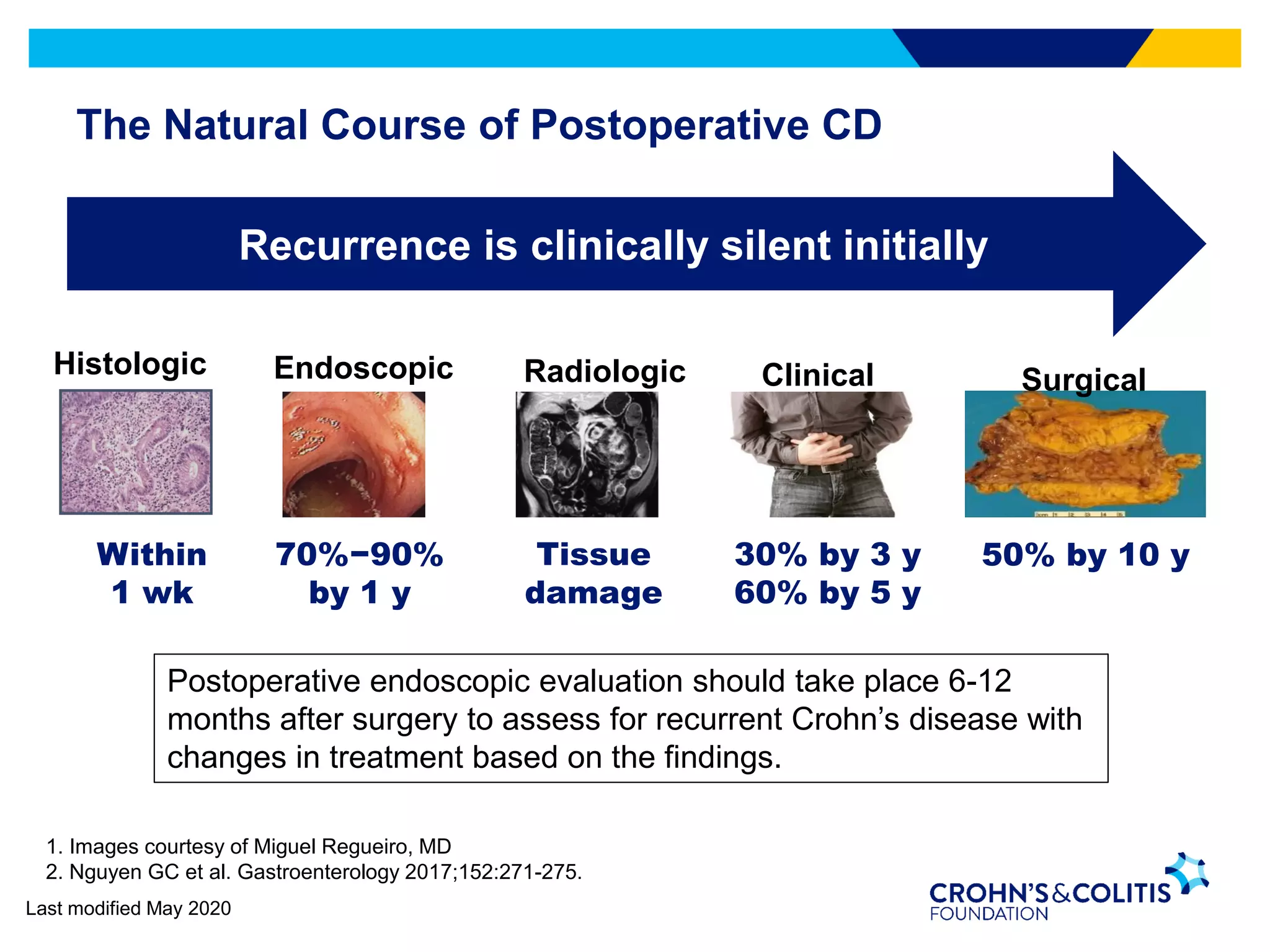 Overview of IBD for Healthcare Professionals | PDF