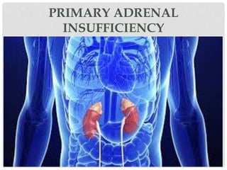 Primary Adrenal Insufficiency | PPTX