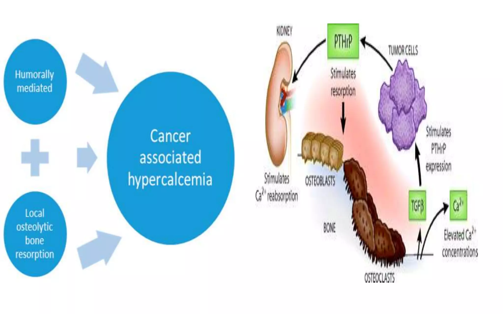 Final paraneoplastic syndromes | PPT