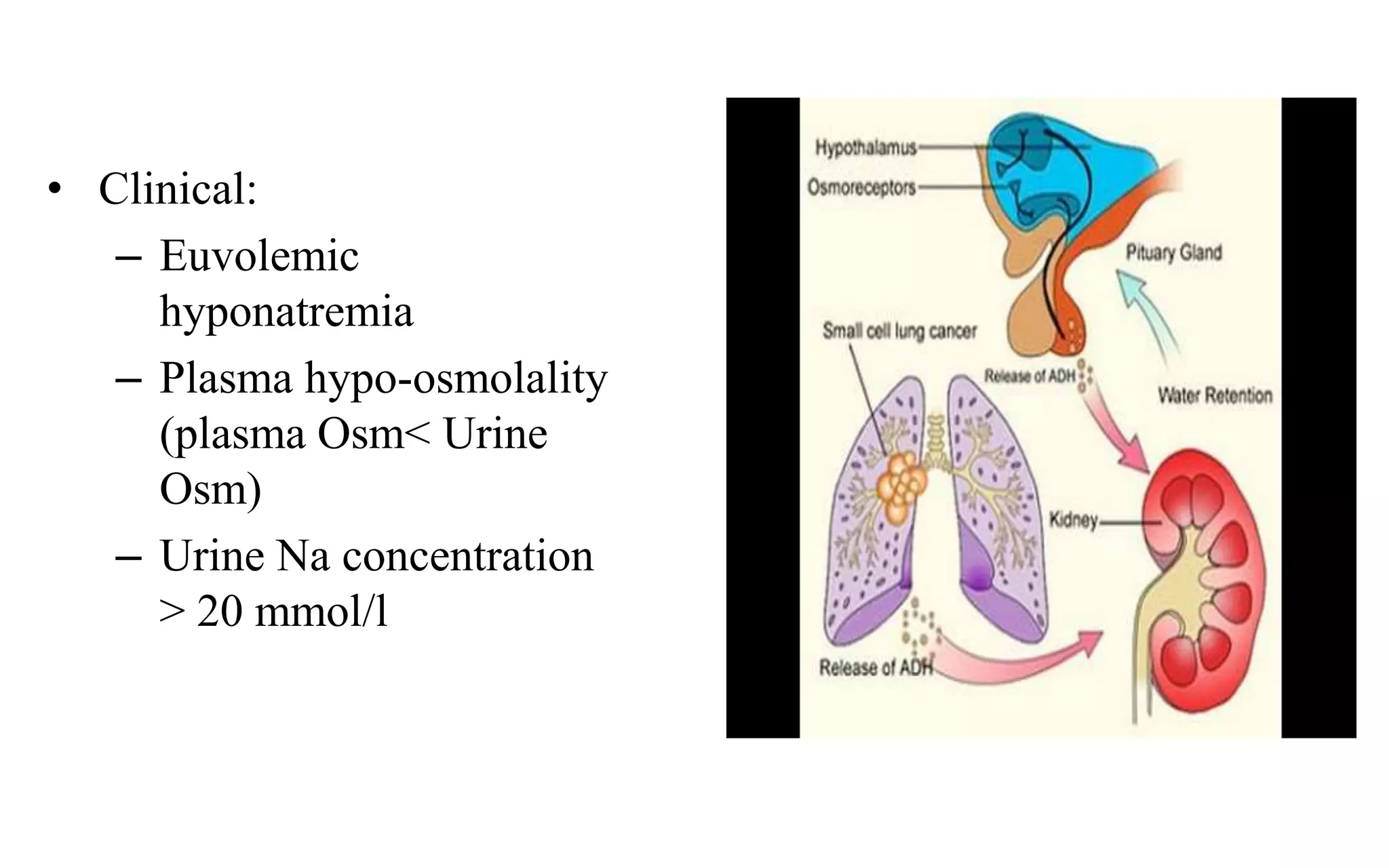 Final paraneoplastic syndromes | PPT