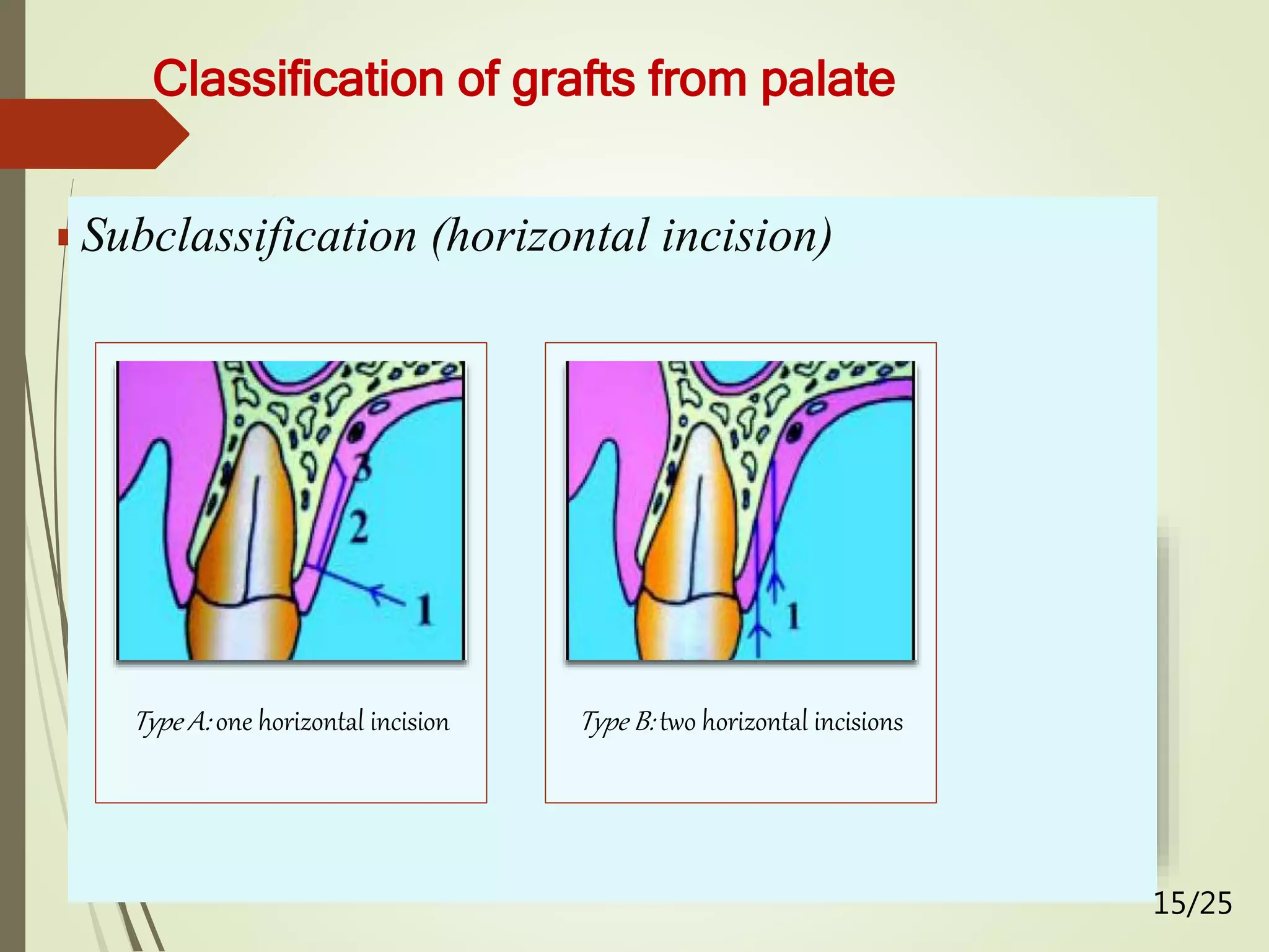 Part 1 Mucogingival Surgery | PPTX