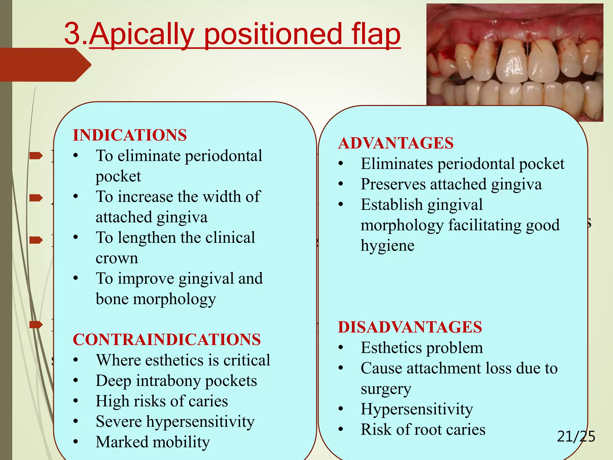 Part 1 Mucogingival Surgery | PPTX