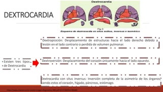 Embriologia Cardiovascular , revision desde el punto de vista ...