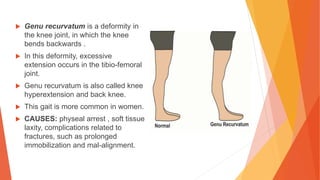 Pathological gaits.pptx