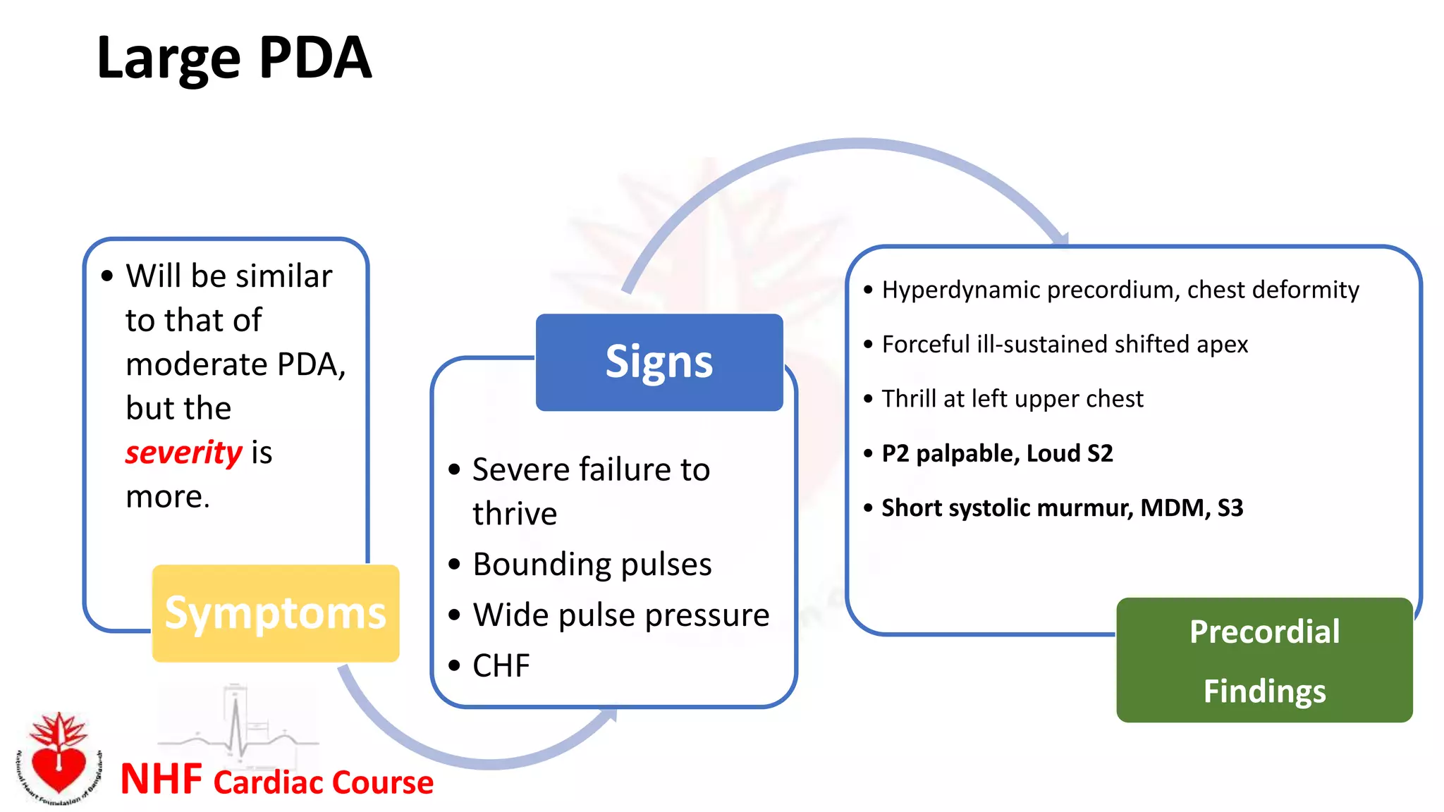 Patent Ductus Arteriosus: Clinical manifestation and Diagnosis | PPT