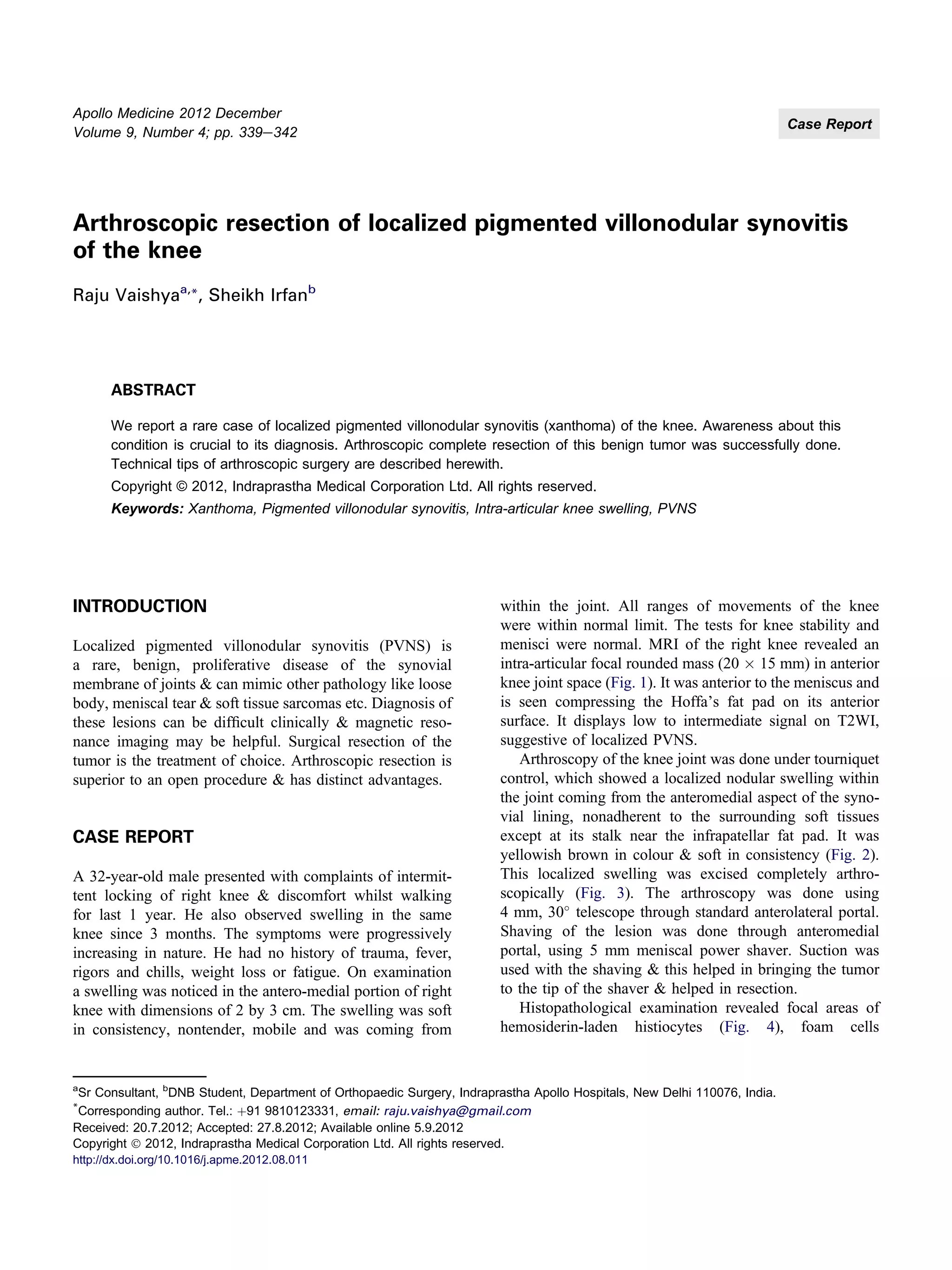 Arthroscopic Resection of Localized Pigmented Villonodular Synovitis of the Knee | PDF | Bone ...