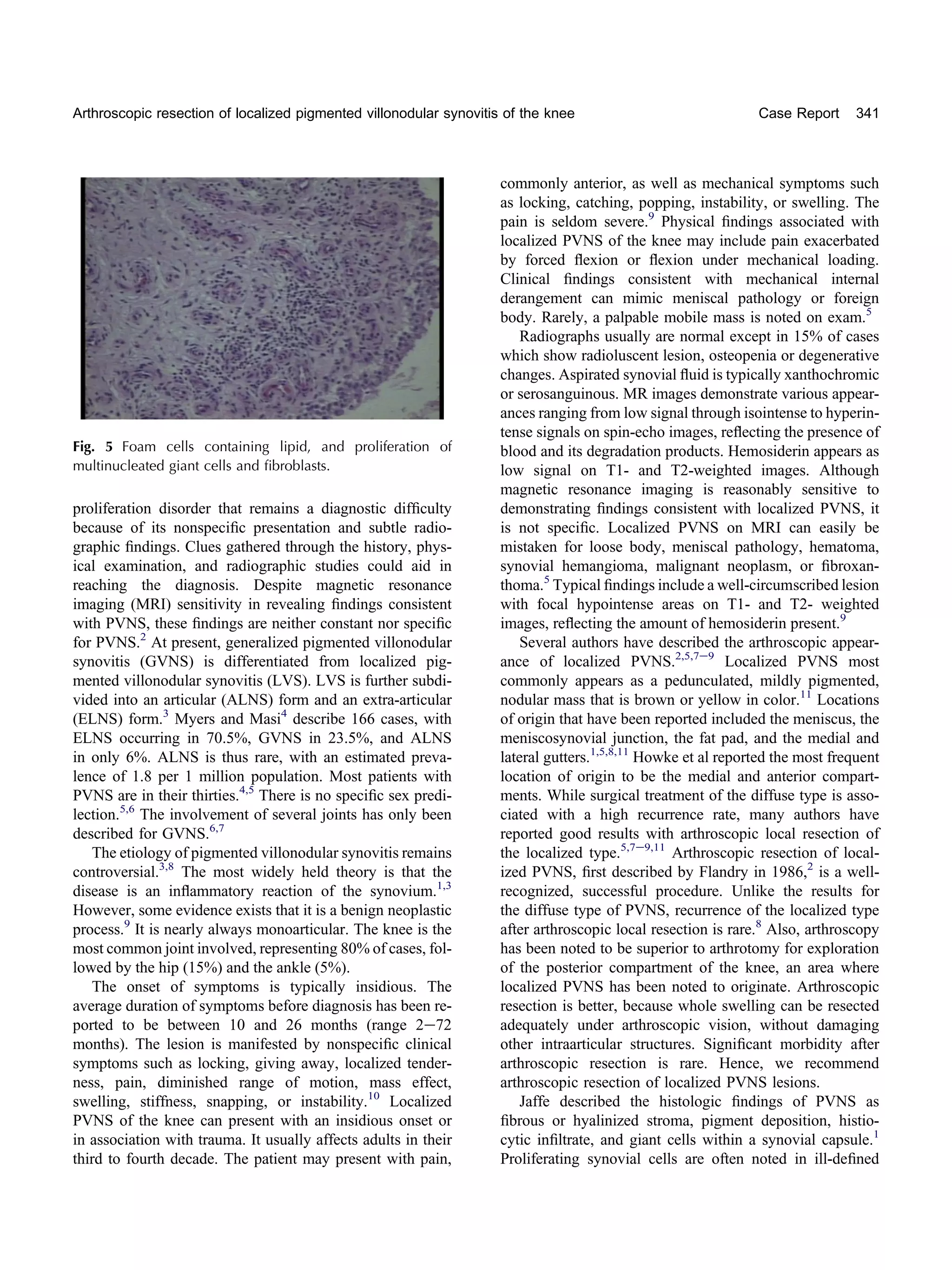 Arthroscopic Resection of Localized Pigmented Villonodular Synovitis of ...