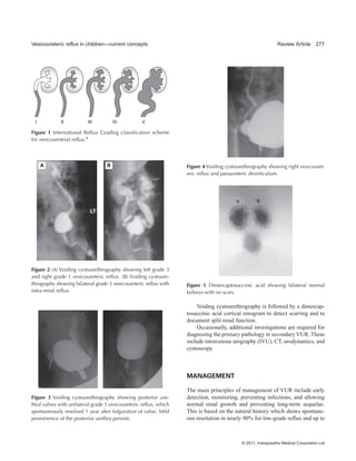 Vesicoureteric Reflux in Children—Current Concepts | PDF
