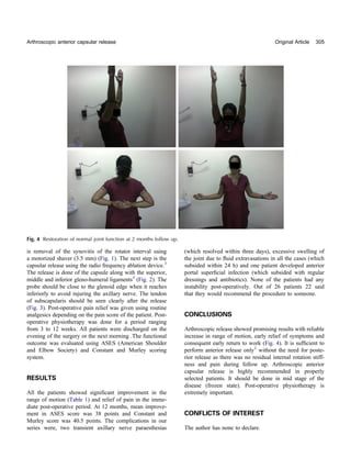 Arthroscopic Anterior Capsular Release for Idiopathic Frozen Shoulder | PDF