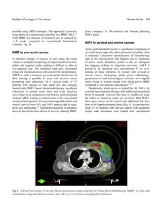 Radiation Oncology in 21st Century - Changing the Paradigms | PDF