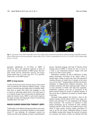 Radiation Oncology in 21st Century - Changing the Paradigms | PDF