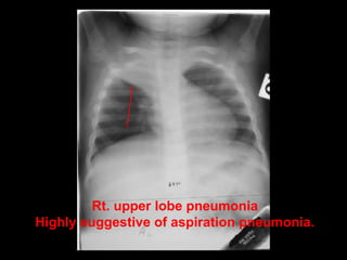 PEDIATRIC RADIOLOGY copy.ppt upload to download so you download to ...