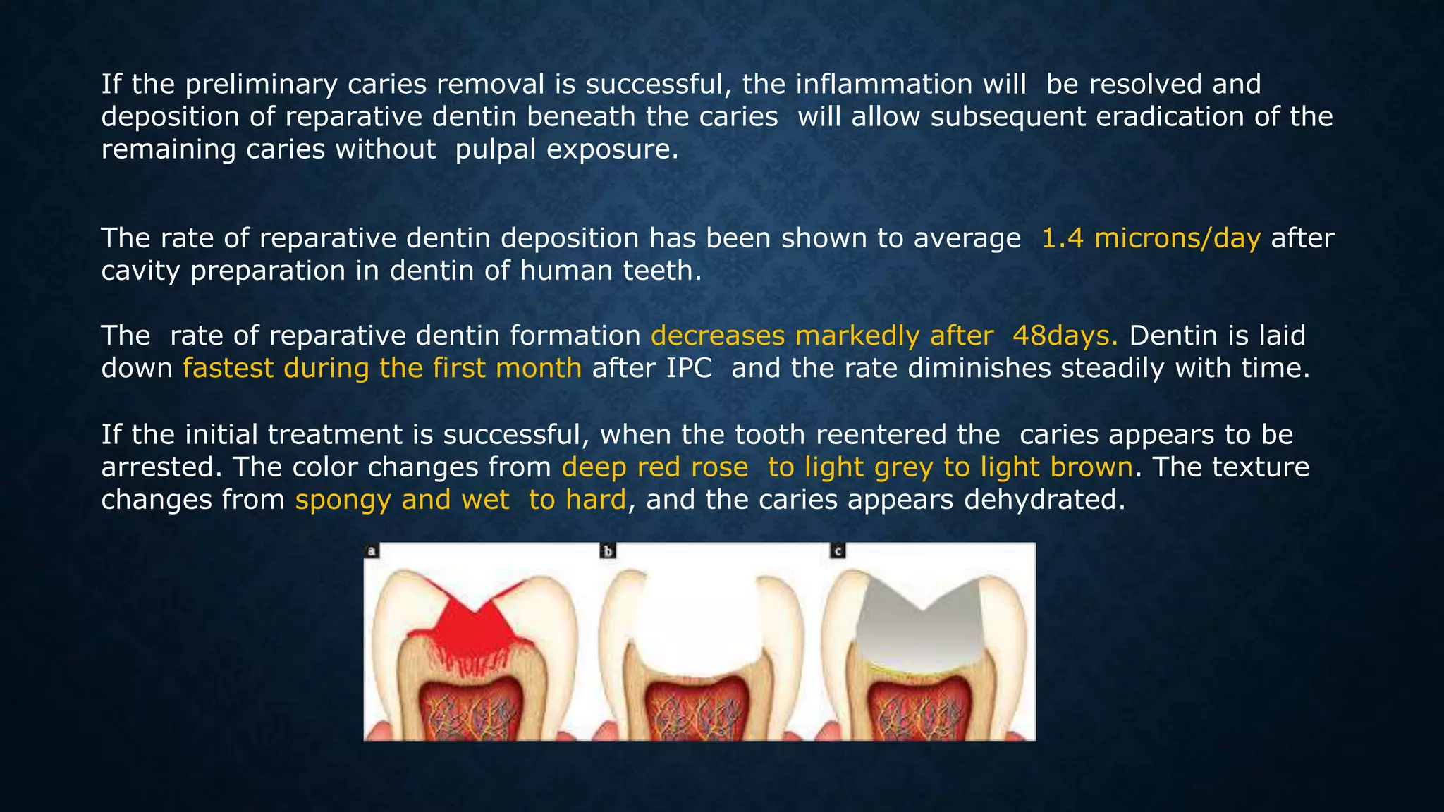 Pediatric Endodontics - Indirect and Direct pulp capping,Pulpotomy ...