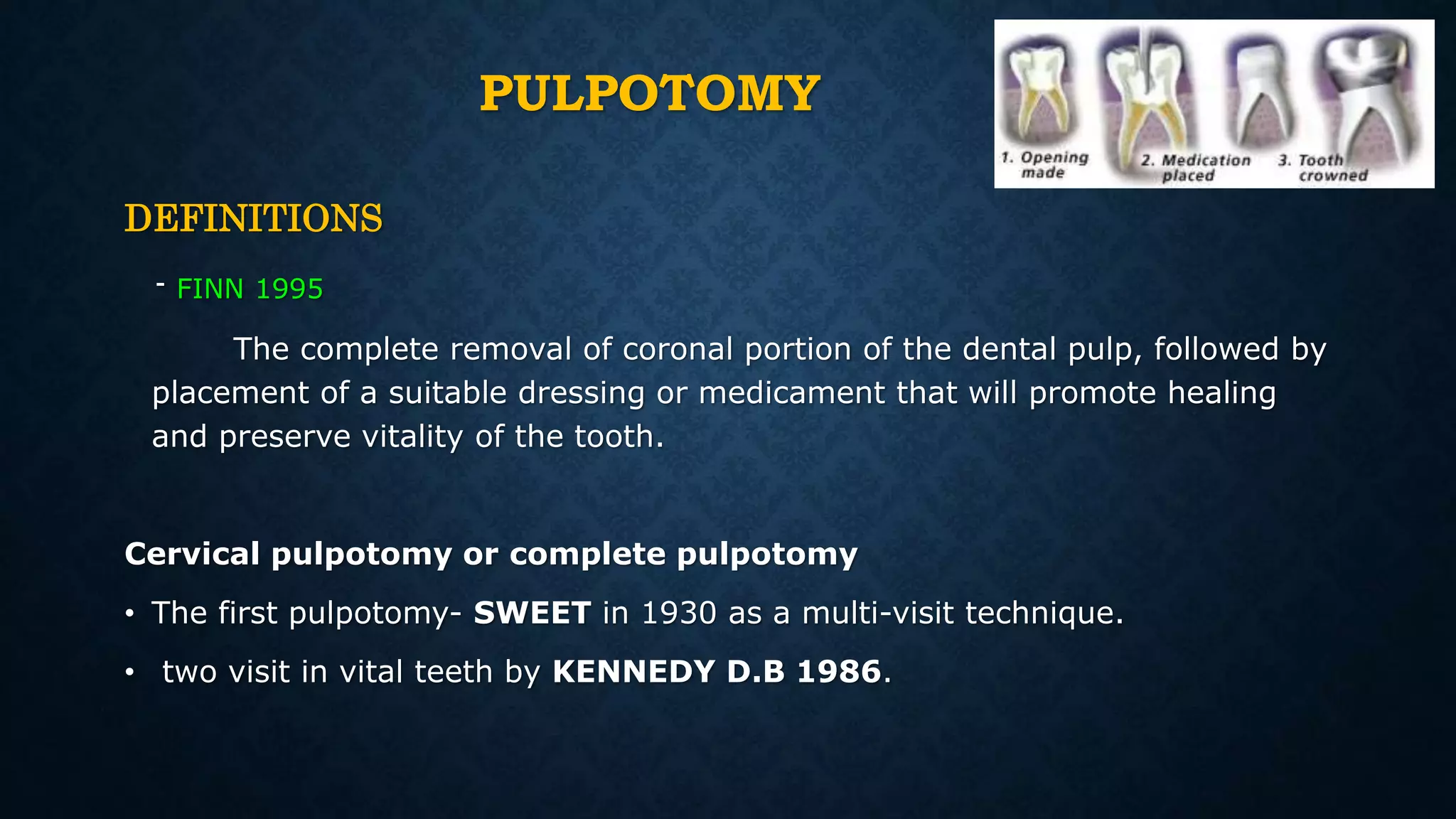 Pediatric Endodontics - Indirect and Direct pulp capping,Pulpotomy ...
