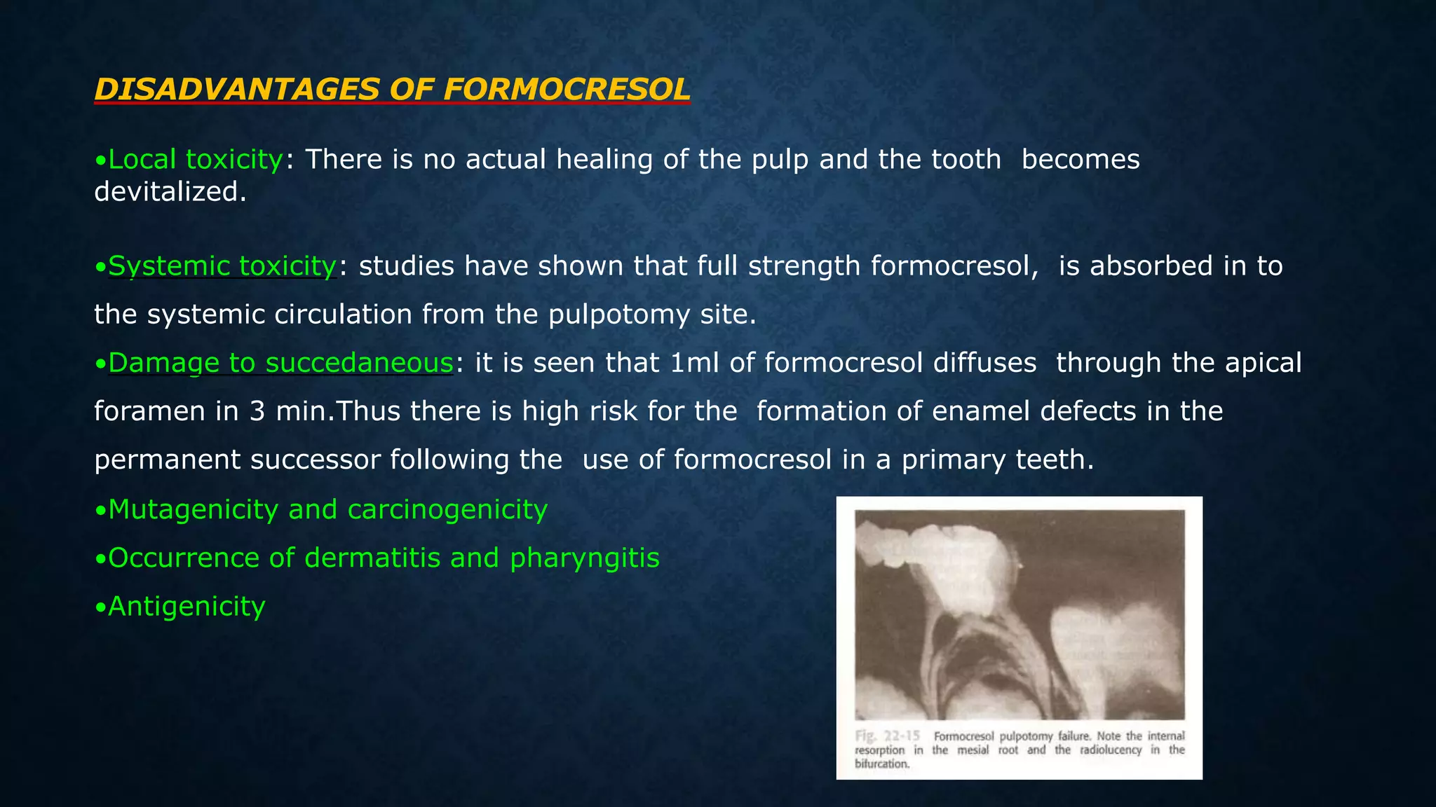 Pediatric Endodontics - Indirect and Direct pulp capping,Pulpotomy ...