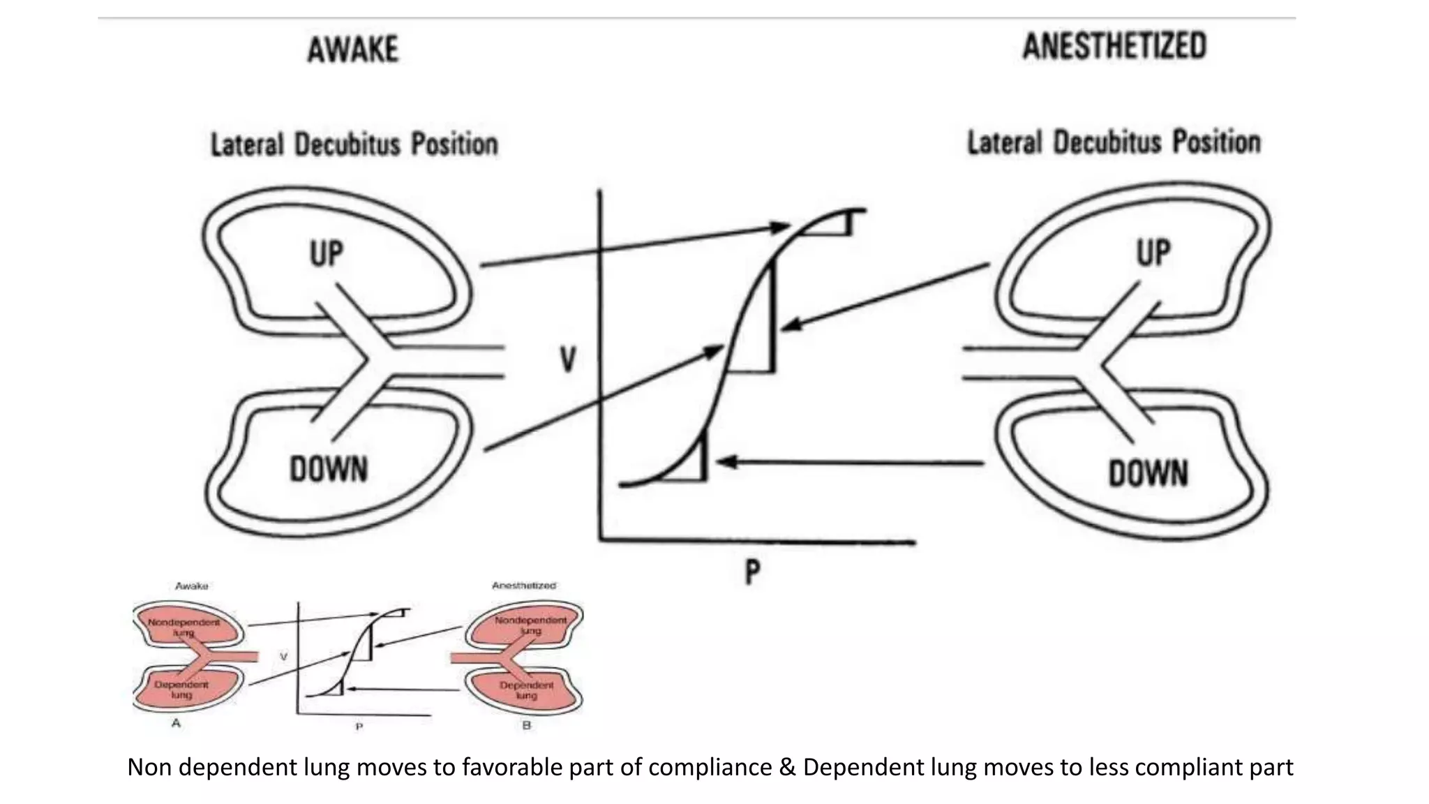 PHYSIOLOGY OF One lung ventilation.pptx