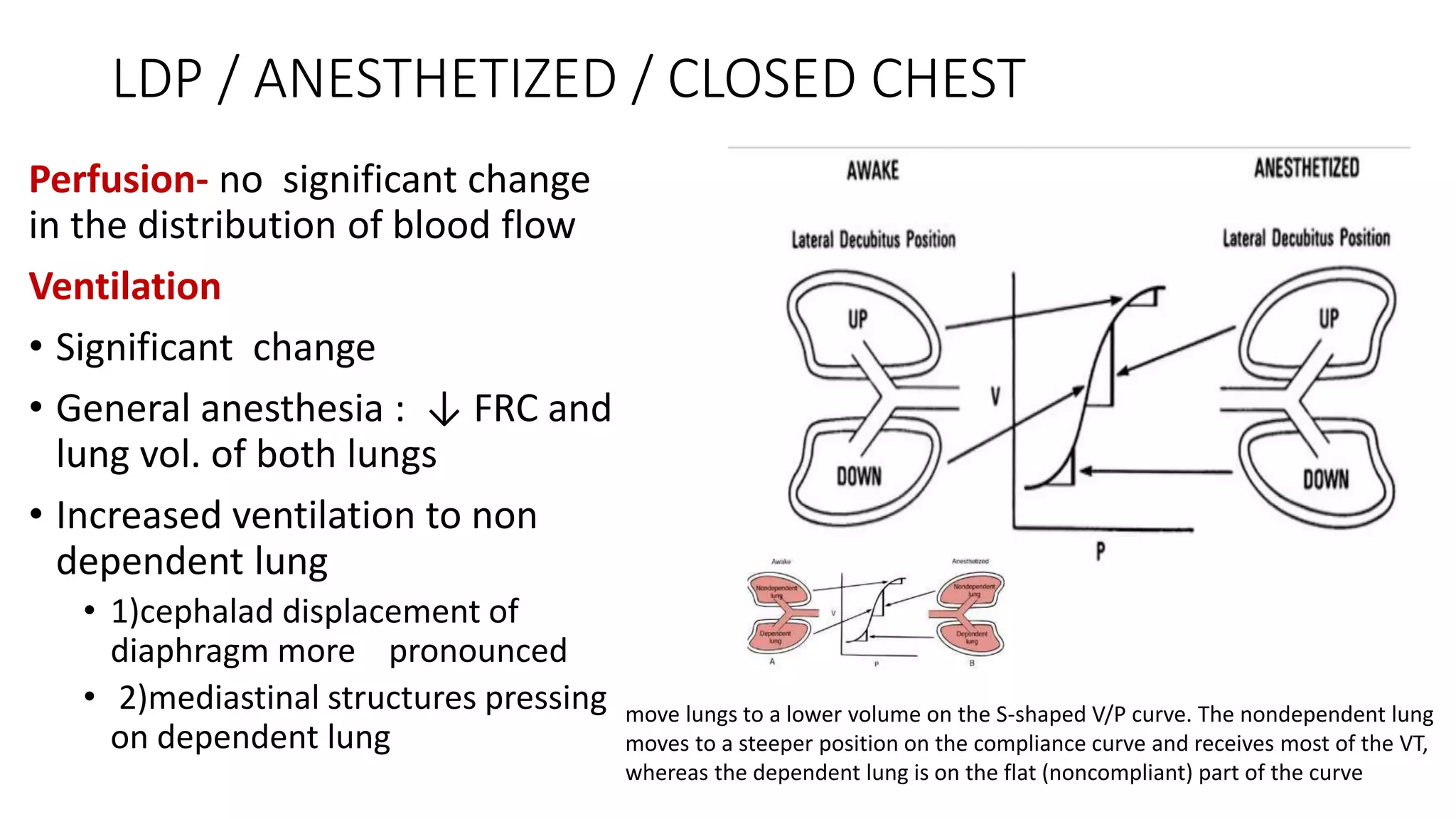 PHYSIOLOGY OF One lung ventilation.pptx