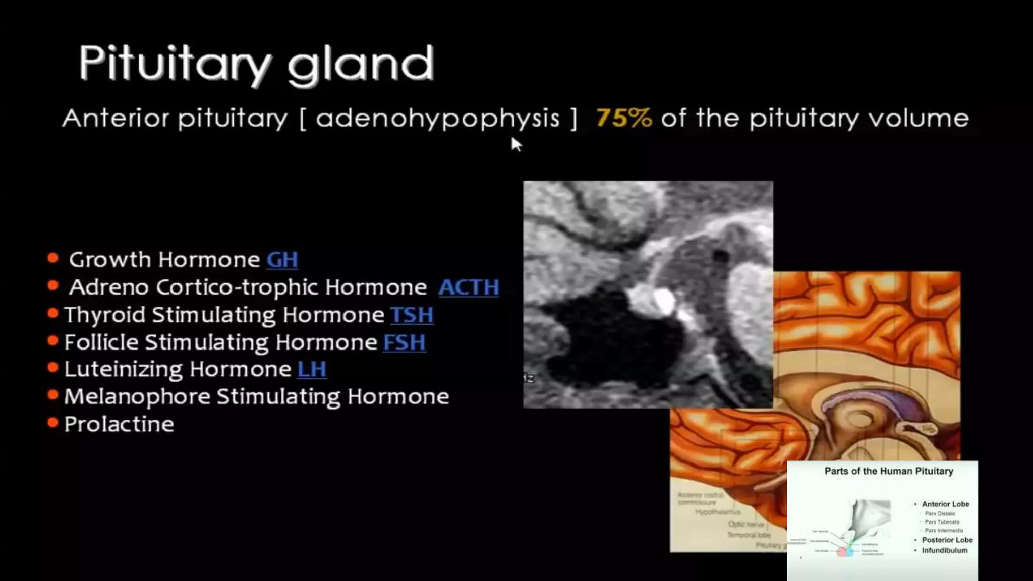 pituitary tumors management | PPT