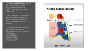 pituitary tumors management | PPTX