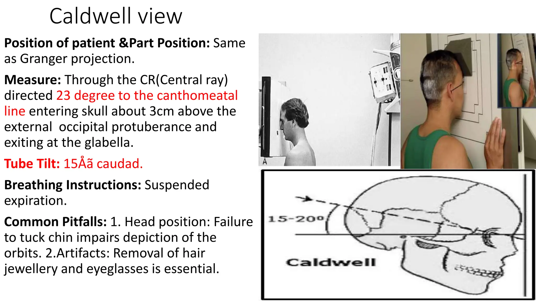 Overview of Paranasal sinus Radiology.pptx