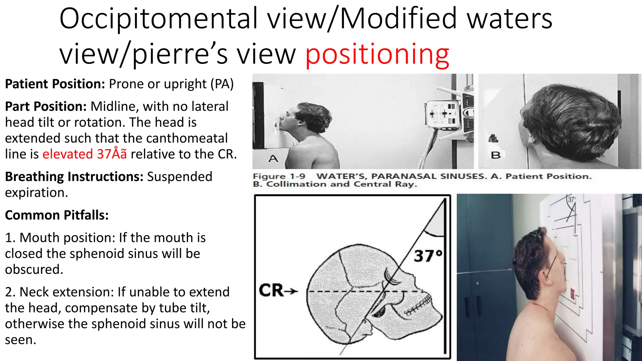 Overview of Paranasal sinus Radiology.pptx