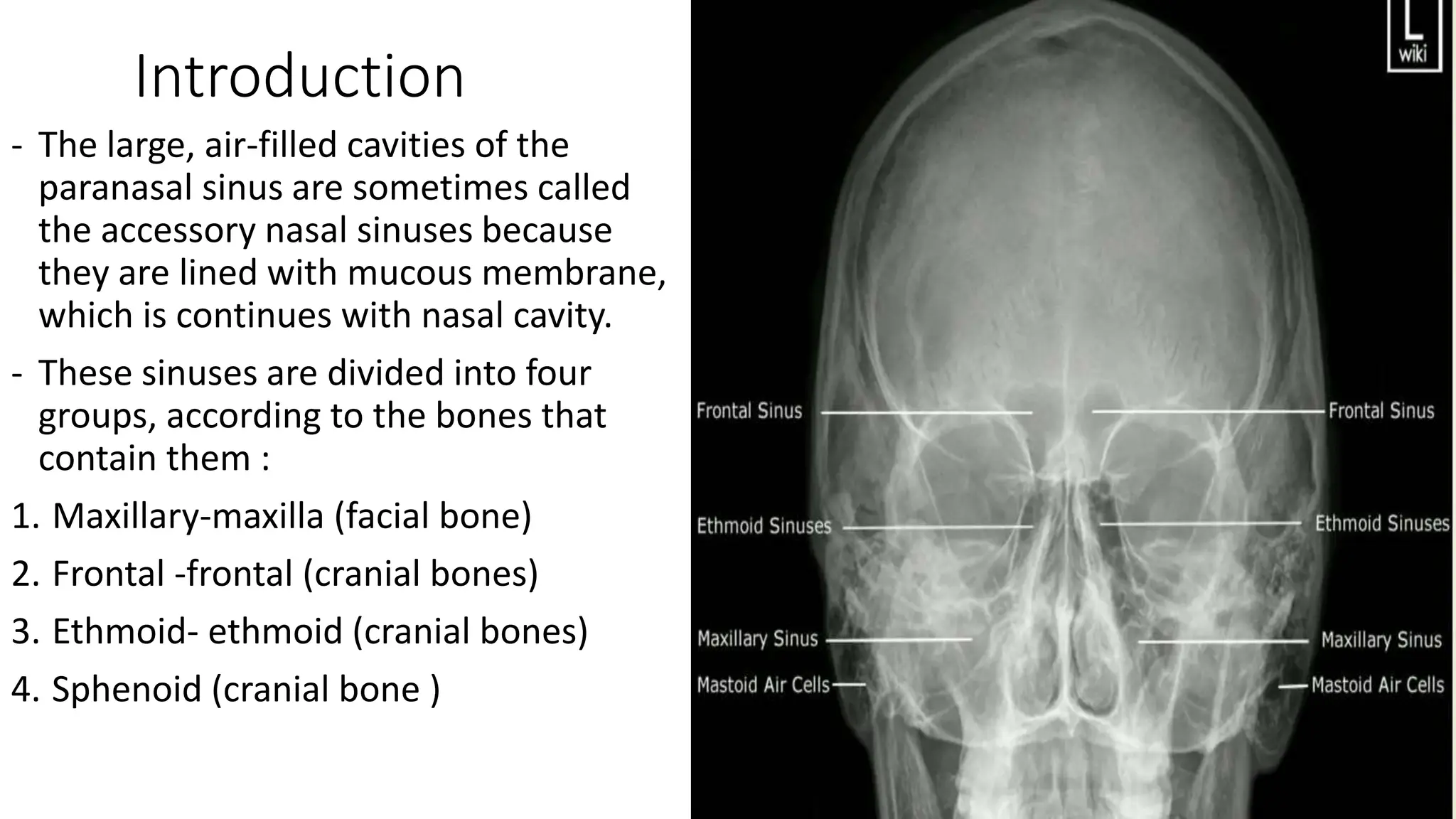Overview of Paranasal sinus Radiology.pptx
