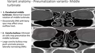 Overview of Paranasal sinus Radiology.pptx