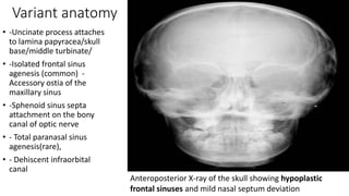 Overview of Paranasal sinus Radiology.pptx