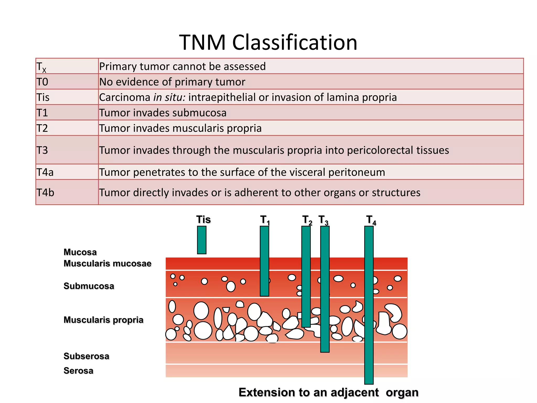 Rectal carcinoma approach | PPTX