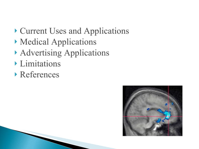 Brain Finger Printing | PPT | Brain and Nervous System Disorders ...