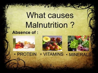 malnourishment in poor and healthy eating habits | PPTX