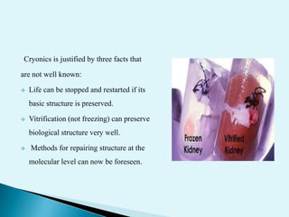 cryonics | PPTX