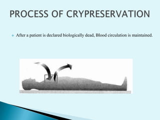 cryonics | PPTX