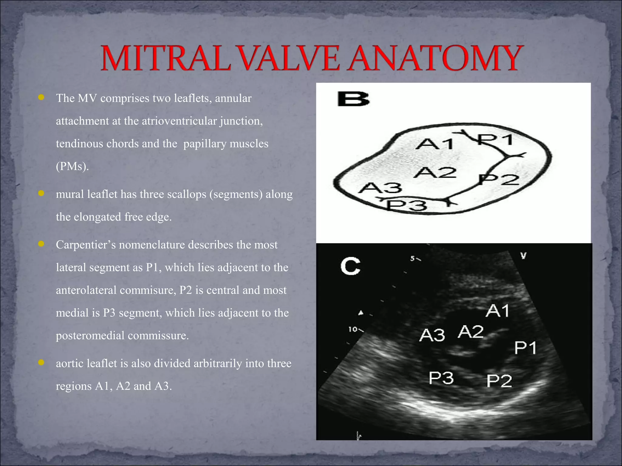 percutaneous therapies for mitral regurgitation | PPT
