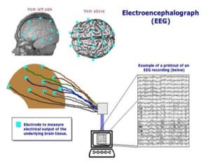 Brain Computer Interface(BCI) | PPT
