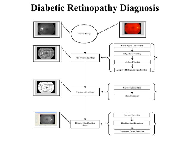 Diabetic Retinopathy Analysis using Fundus Image | PPTX | Eye and ...