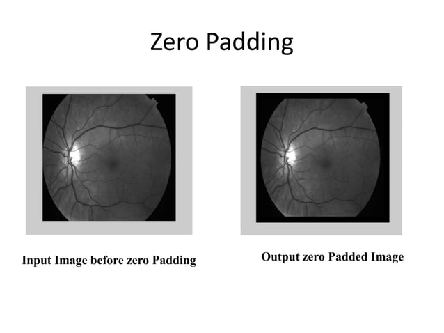 Diabetic Retinopathy Analysis using Fundus Image | PPTX | Eye and Vision Conditions | Diseases ...