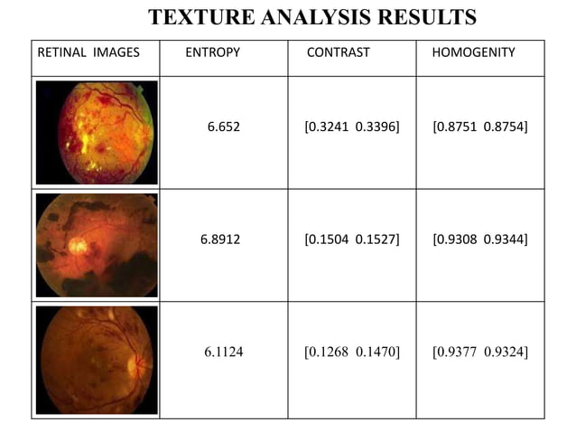 Diabetic Retinopathy Analysis using Fundus Image | PPTX | Eye and Vision Conditions | Diseases ...