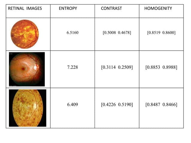 Diabetic Retinopathy Analysis using Fundus Image | PPTX | Eye and Vision Conditions | Diseases ...
