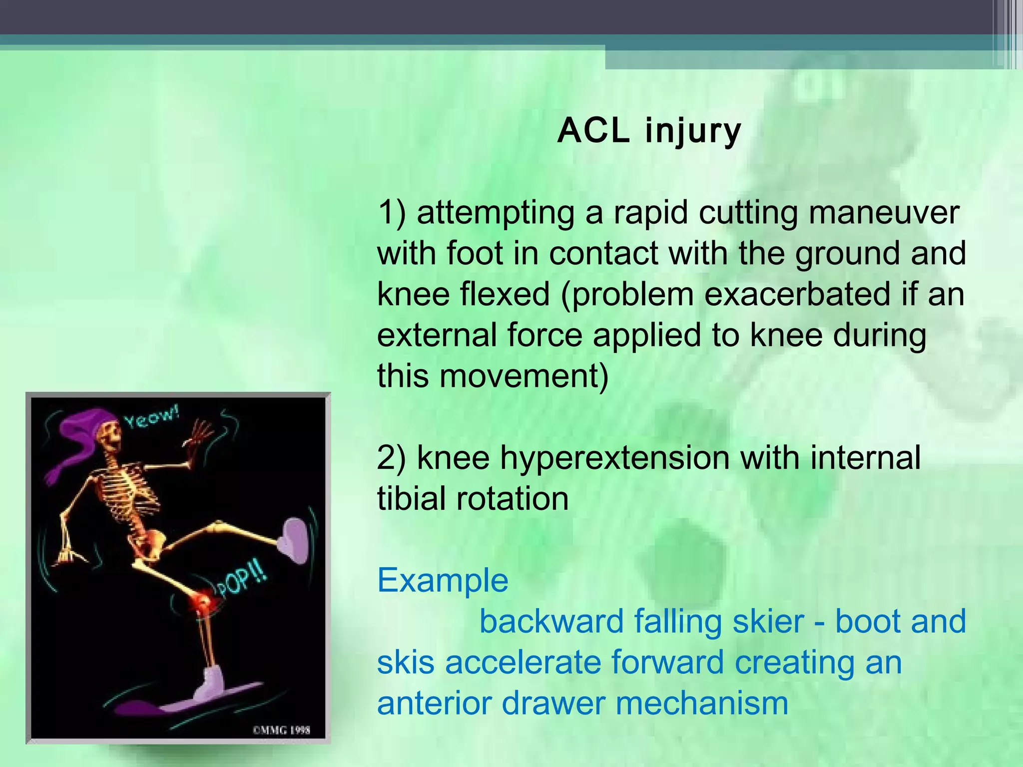 Knee Injuries In Detail | PPT