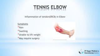 Common Sports Injuries | PPTX | Death, Injury, or Military Conflict ...