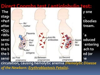 Coomb's test and a case history by darshika taran | PPTX