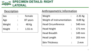 Global Human Body Model Consortium (GHBMC) Head Model Validation | PPTX