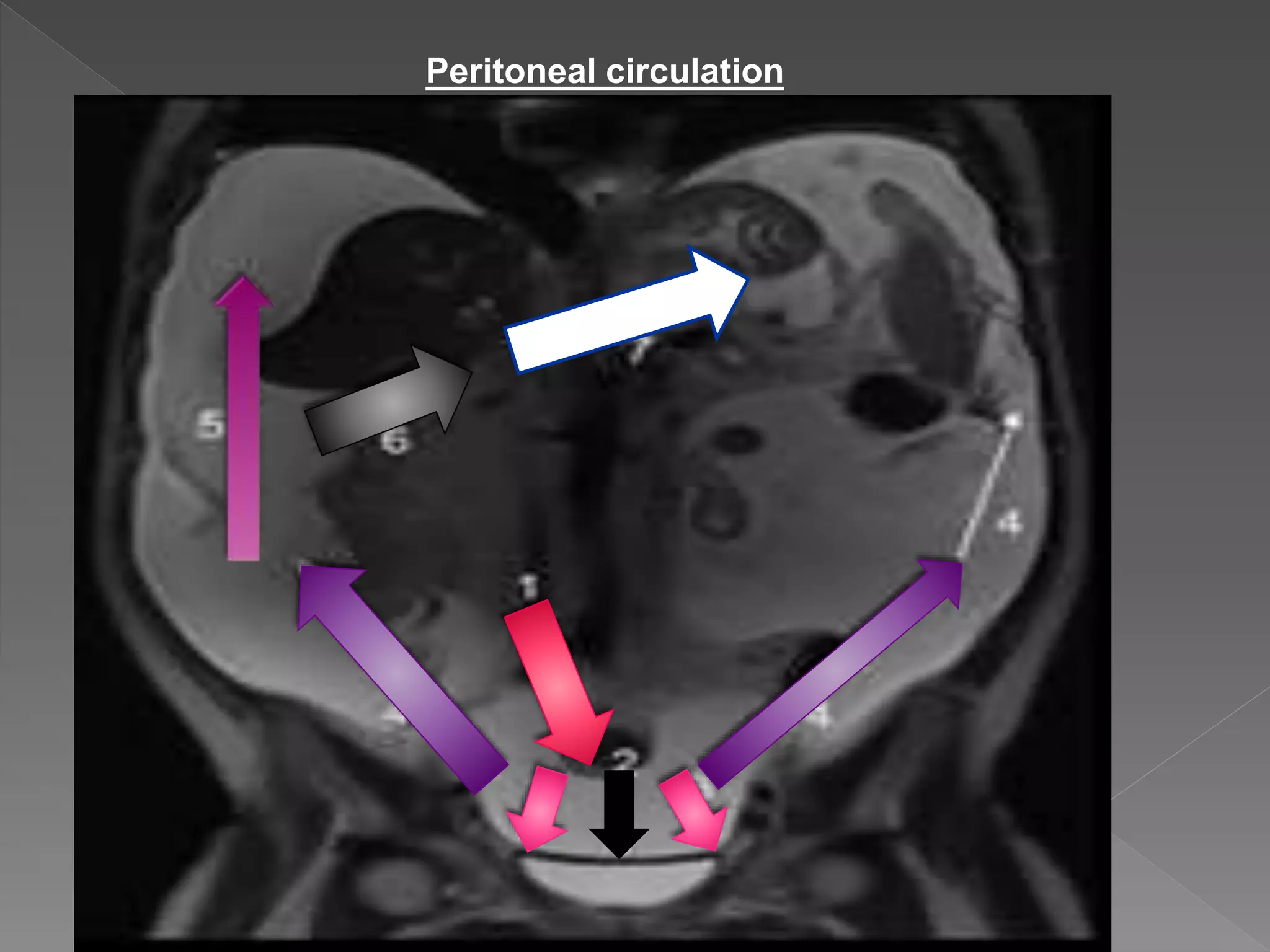 peritoneum | PPTX