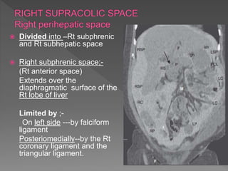 peritoneum | PPTX