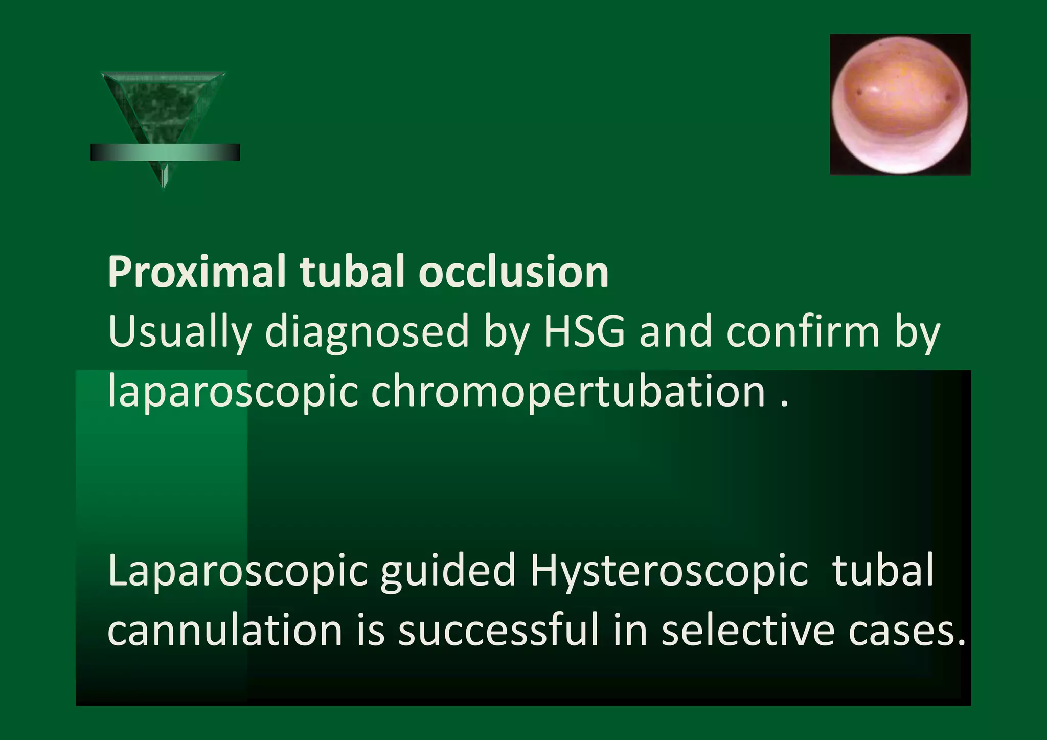The Role of laparoscopy in the era of ART | PPTX