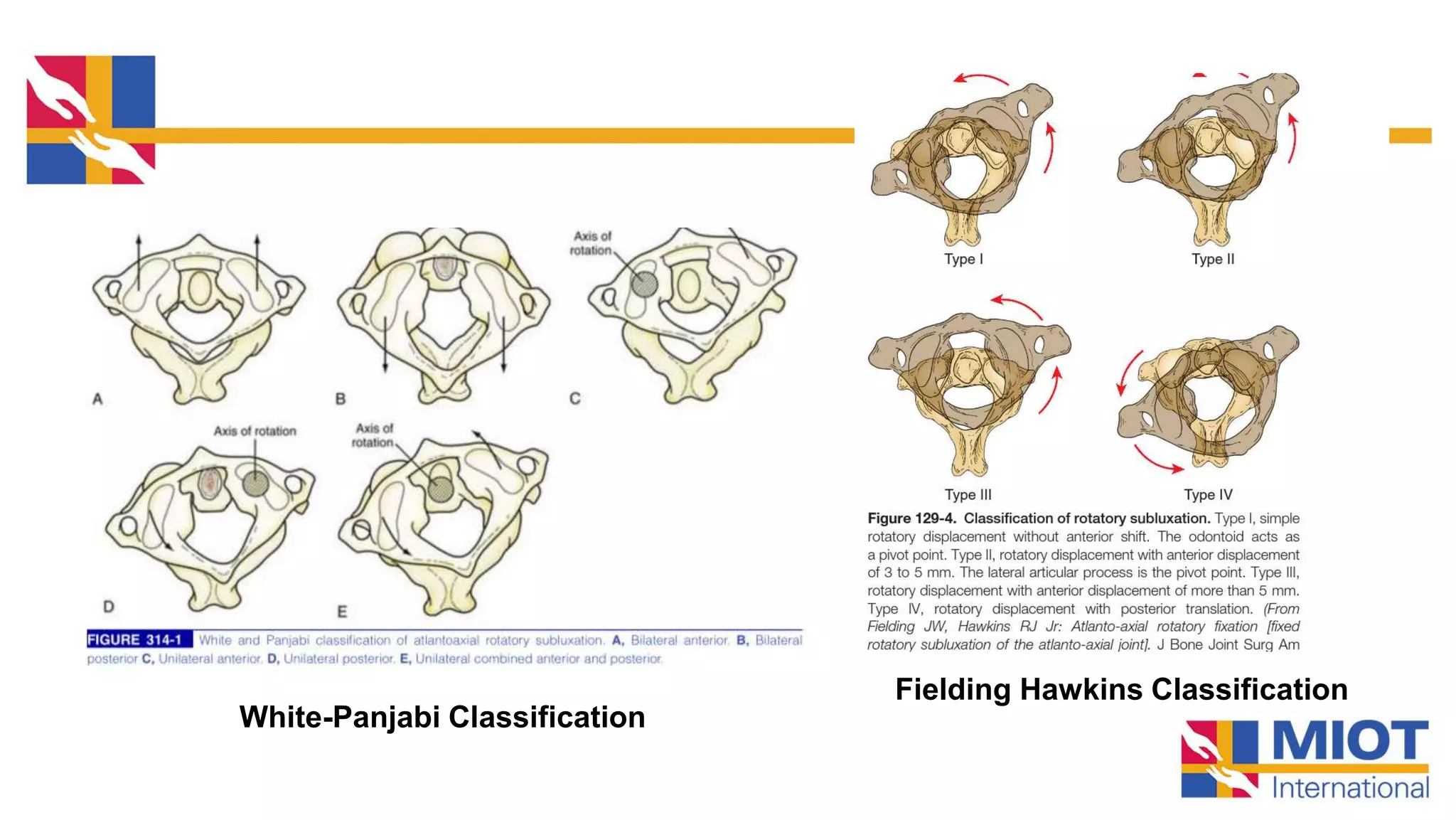 Injuries at occipitocervical junction | PPTX